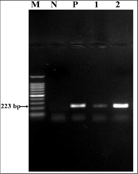 Figure 1 From Molecular Epidemiology Of Brucella Abortus Among Buffaloes In Western Rajasthan