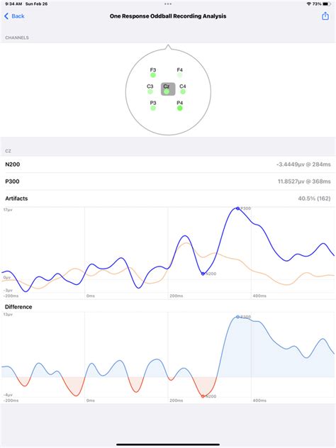 Mobile Eeg