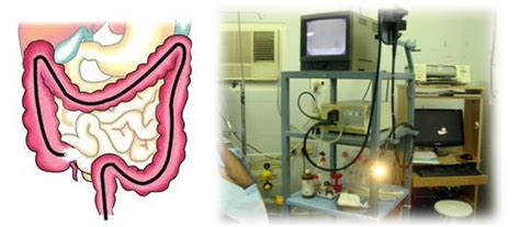 Endoscopy And Colonoscopy Llh Medical Center