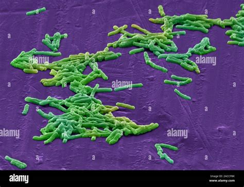 Clostridium Difficile Bacteria Coloured Scanning Electron Micrograph Sem These Rod Shaped