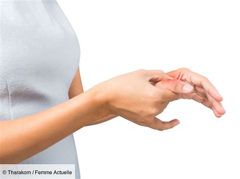 Arthrose Du Pouce Symptômes Causes Et Traitements Femme Actuelle Le Mag