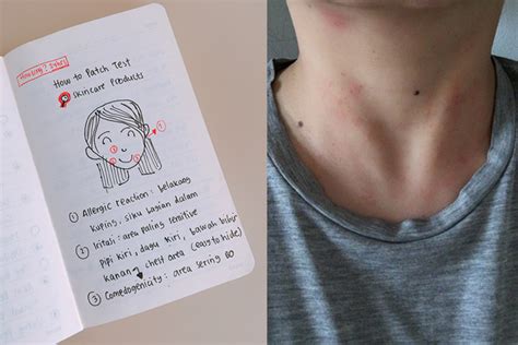 Female Daily Editorial Cara Melakukan Skincare Patch Test