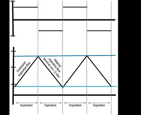 Flow Controlled Ventilation A New And Promising Method Of Ventilation