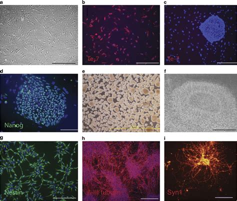 Derivation Characterization And Neuronal Differentiation Of Ipsc