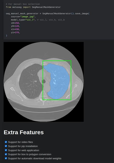 Kadir Nar On Linkedin Objectsegmentation Computervision