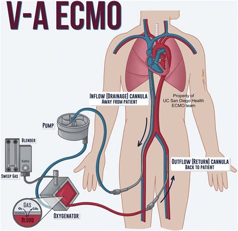 Management Strategies For Acute Pulmonary Embolism In The Icu Chest