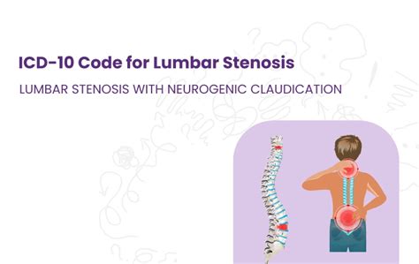Icd 10 Codes For Lumbar Spinal Stenosis Hms Usa Llc