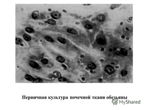 Вирус Echo презентация онлайн