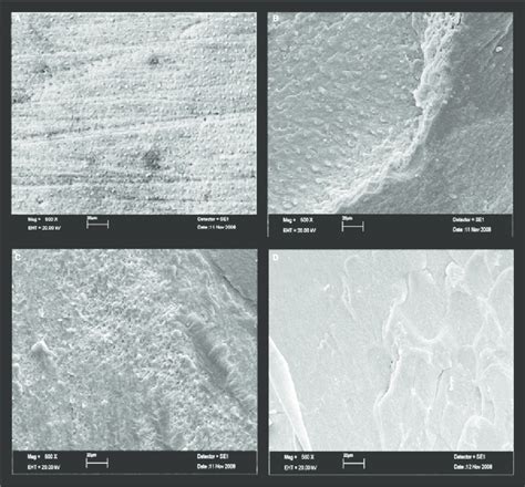 Most Representative Fracture Patterns Observed In The Present Study A Download Scientific