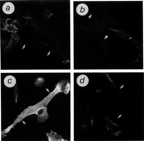 Indirect Immunofluorescence Stainingfor Surface Expression Ofadhesion Download High Quality