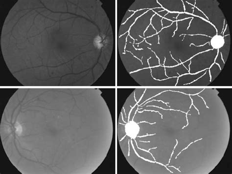 The Results Of The Segmentation Algorithms Download Scientific Diagram