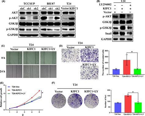 Kifc1 Activated Aktgsk3β Signaling To Induce Proliferation And Emt Of