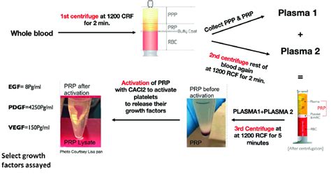 Diagram Showing The Processing Method Performed In Our Lab To Obtain Download Scientific