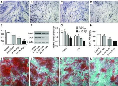 The Osteogenic Differentiation Abilities Of Pdlscs Cultured In
