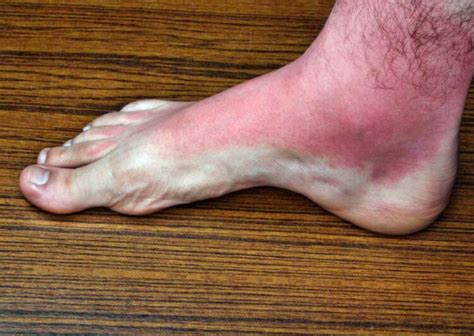 7 Common Causes Of Itchy Rashes On Legs We Cater To All Your Needs From