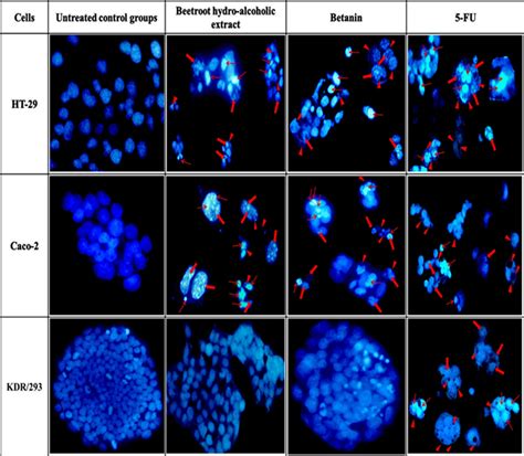 Dapi Staining Of Treated Untreated Ht 29 T Caco 2 And Kdr 293 Cells Download Scientific