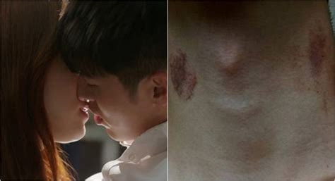 여자친구와 뜨거운 키스 나눈 후 갑자기 쓰러져 숨진 남성 포스트쉐어