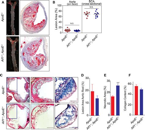 Aif1 Limits Necrotic Core Expansion Without Affecting Atherosclerotic