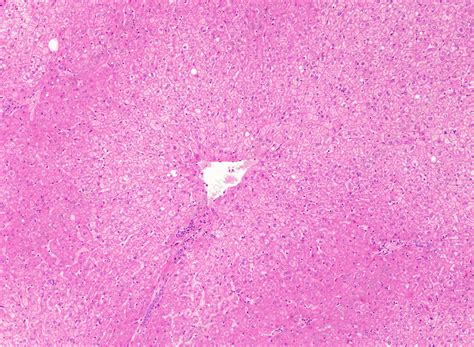 Human Liver Tissue Light Micrograph Stock Image C060 6860 Science Photo Library