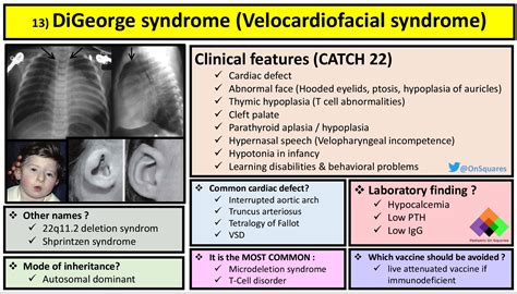 Velocardiofacial Syndrome Symptoms Genetics Of Common Congenital