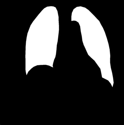 Lung Detection And Segmentation In X Ray Image Signal Processing Stack Exchange