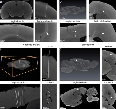 Electrode Localization Through Micro Ct Imaging A Single Tetrode