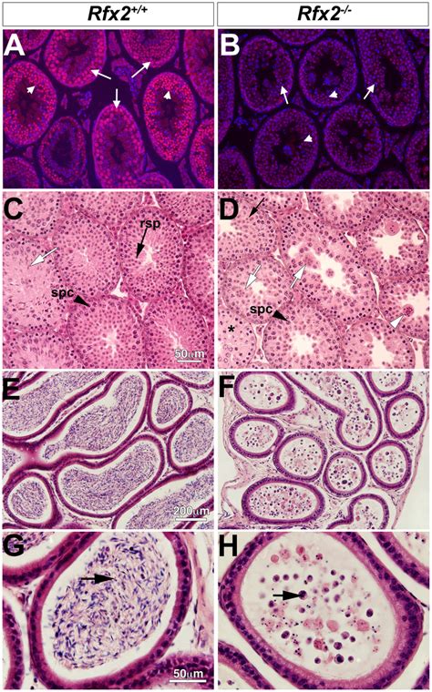 Spermatogenesis Is Arrested In Rfx2 Mice A B Testis Sections From