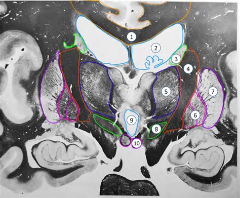 Diencephalon Fig 67 Diagram Quizlet Diencephalon Fig 67 Diagram Quizlet