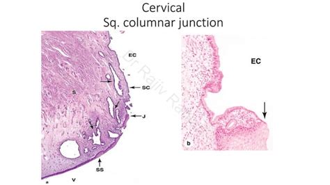 Histology Of Cervix And Vagina Pdf