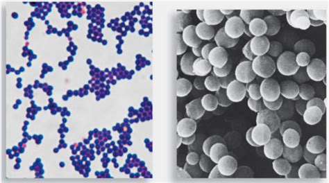Id Lecture 1 Strep Staph Clostridium Diphtheria Flashcards Quizlet
