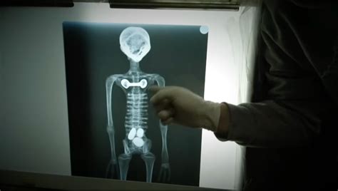 Scientists Confirm That One Of The Mexican Aliens Is Alive After Controversial Research