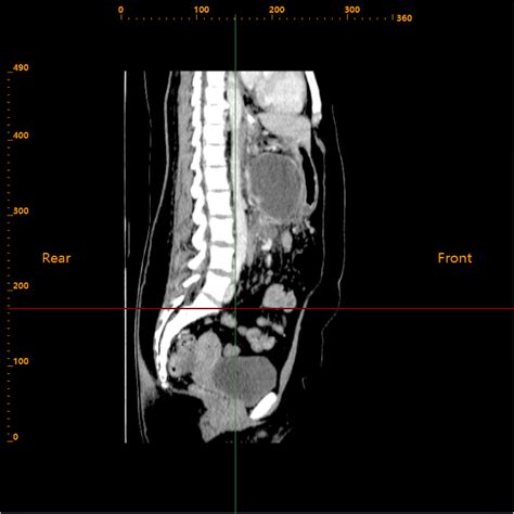 Free DICOM Viewer Online High Performance Medical Imaging Solution DPEA