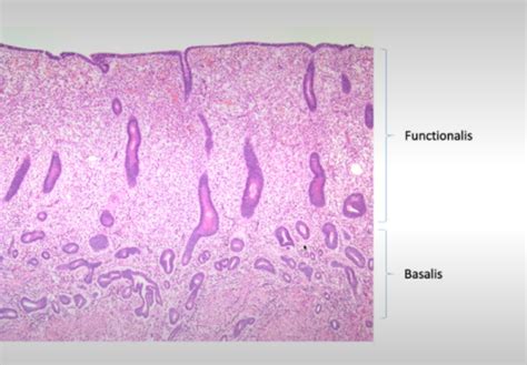 Disease Of Uterus And Pregnancy Flashcards Quizlet