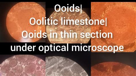 Ooids Oolitic Limestone Ooids In Thin Section Under Optical