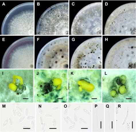 Diaporthe Citri A Fungal Pathogen Causing Melanose Disease