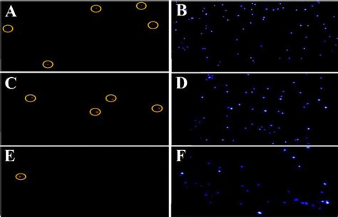 Comparison Of In House Microfluidic Device And Centrifuge Based Method Efficacy In Sperm