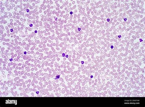 Blood Cells Light Micrograph Stock Photo Alamy