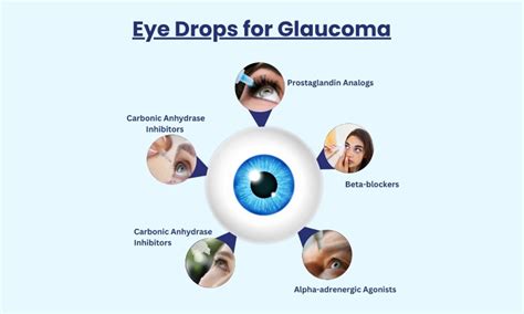 Understanding Glaucoma Treatment Options And Recommendations