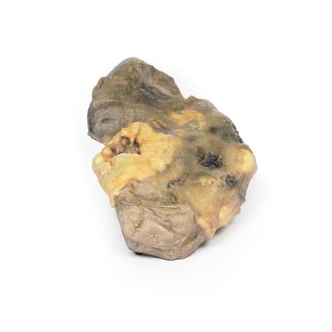 Pyonephrosis Australian Physiotherapy Equipment