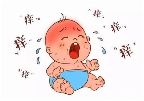当宝宝娇嫩的皮肤遇上湿疹和蚊虫叮咬，宝爸宝妈们忍心吗？ 知乎