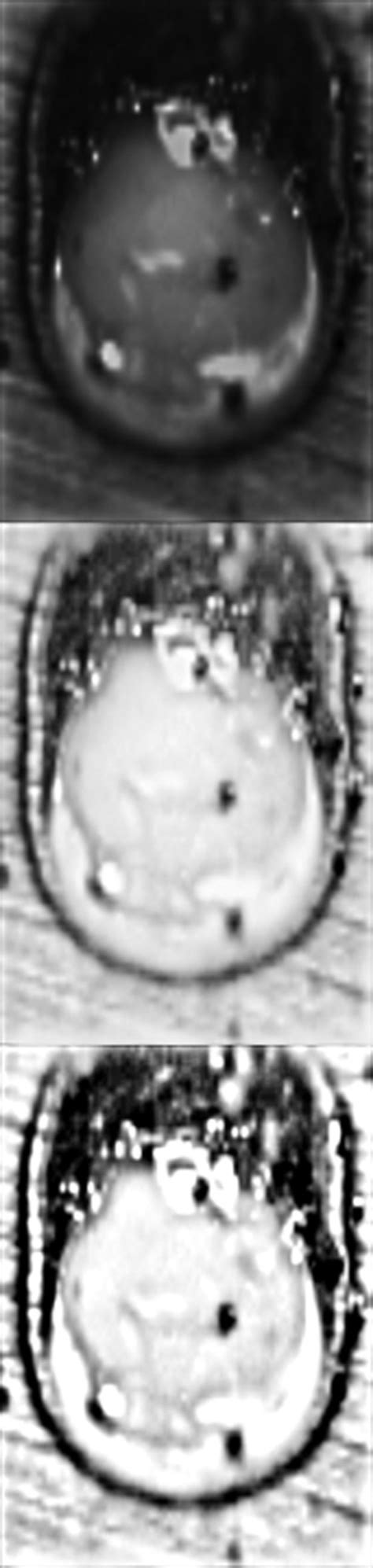 In Order Of Sequential Application From Top To Bottom The Effect Of Download Scientific