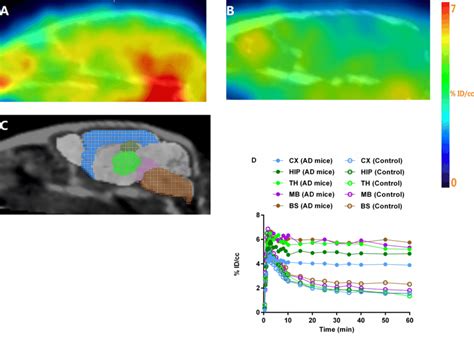 Brain Regional Ps1γ Secretase Expression In 5xfad Transgenic And Download Scientific Diagram