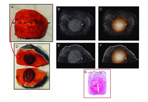 Digital Photograph Of The Intact Right Partial Nephrectomy Specimen Download Scientific Diagram
