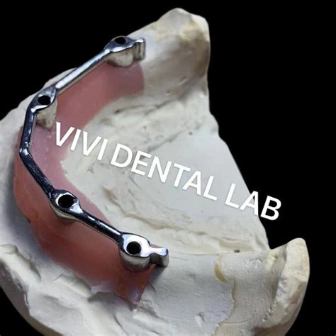 Sheftner Ivoclar Implant Overdenture Bar With Preci Attachments Metal Clips