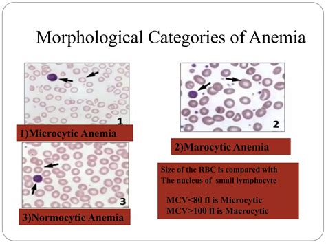 Microcytic Hypochromic Anemia Pptx