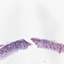 Missing Features Tiles Problem Issue Katherlab Preprocessing Ng Github