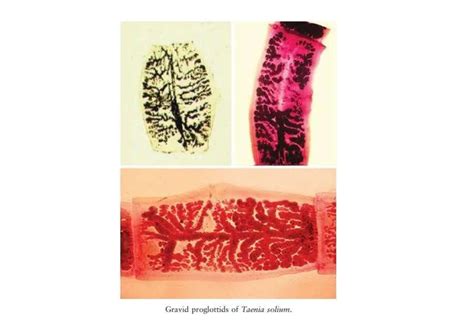 “overview Of Intestinal Cestodes Types Life Cycle And Diseases” Pdf