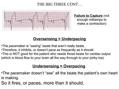 Algorithm For Rhythm Interpretation1 Ppt