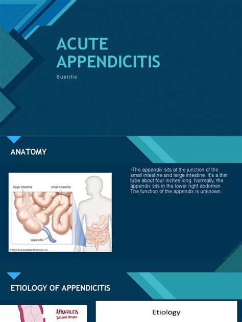 Acute Appendicitis Pdf