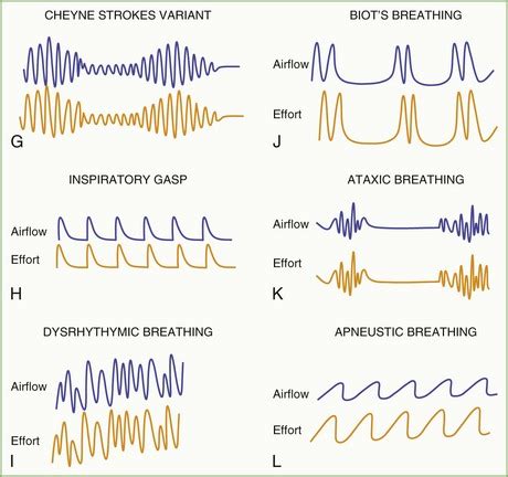 Sleep And Its Disorders Clinical Gateclinical Gate